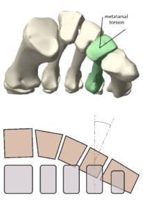 Evolution – Arched Foot