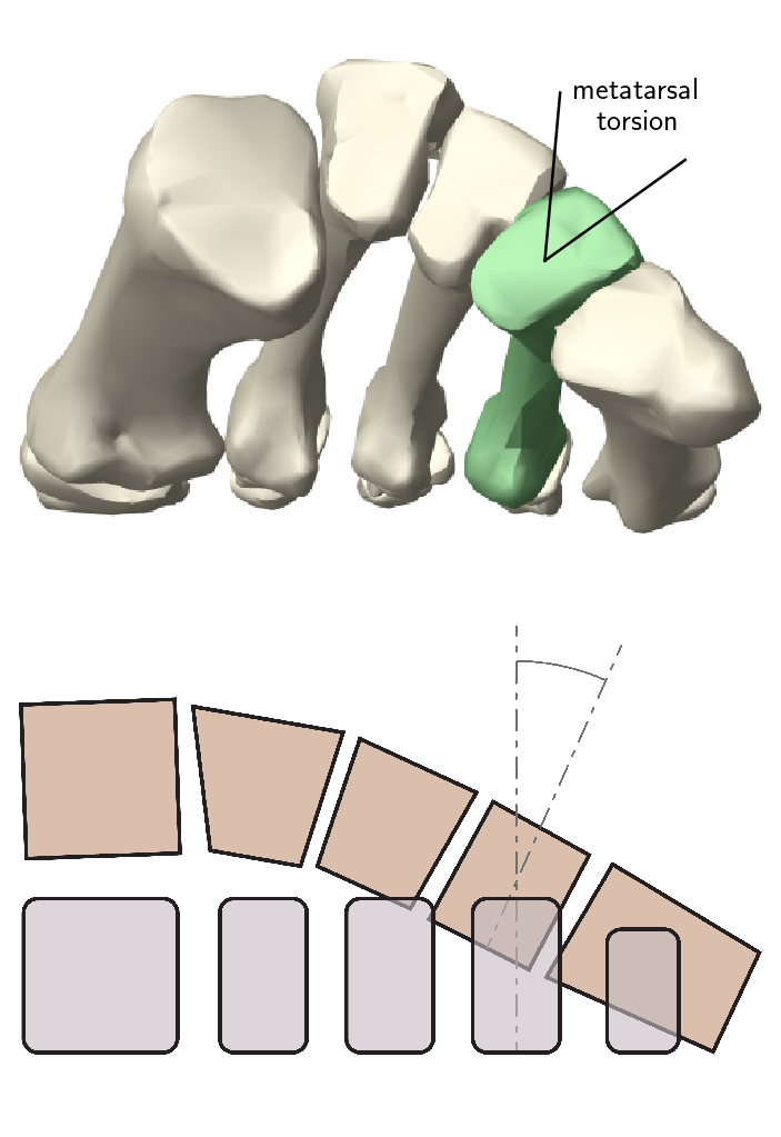 Evolution – Arched Foot